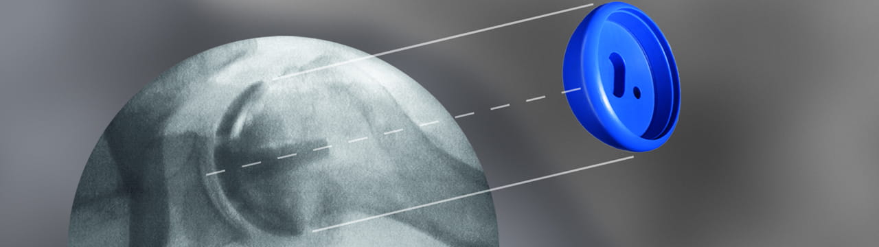 X-ray detectable plastics | Ensinger